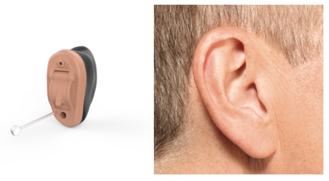 Ear Candy: A Walkthrough of Hearing Aid Styles | Sound Hearing