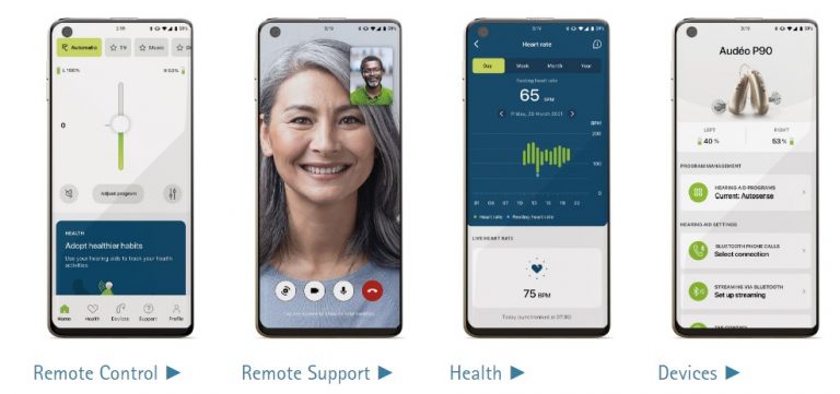 Phonak Audéo Lumity Hearing Aids Review