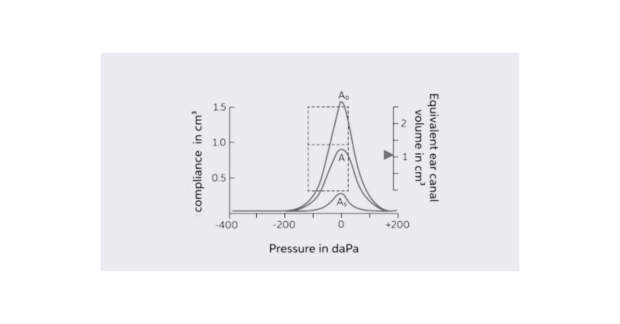 What is a Tympanometry Test? 9 Things You Need to Know