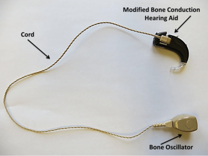 Bone Conduction Test for Hearing Loss | What it is, How it Works